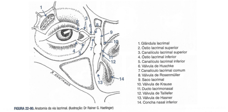 Dacriocistografia e a obstrução do canal lacrimal - Aura | Diagnóstico ...